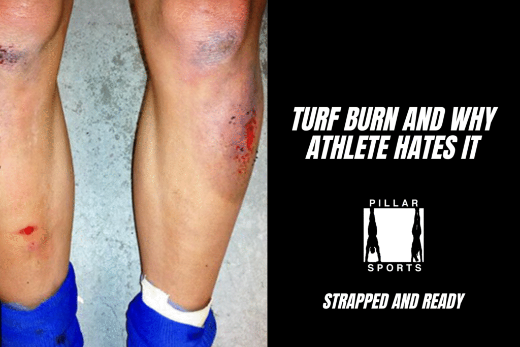 What Is Turf Burn (And Why Smart Athletes Prevent It)